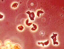 Chapter2a - Protozoan pseudofungi